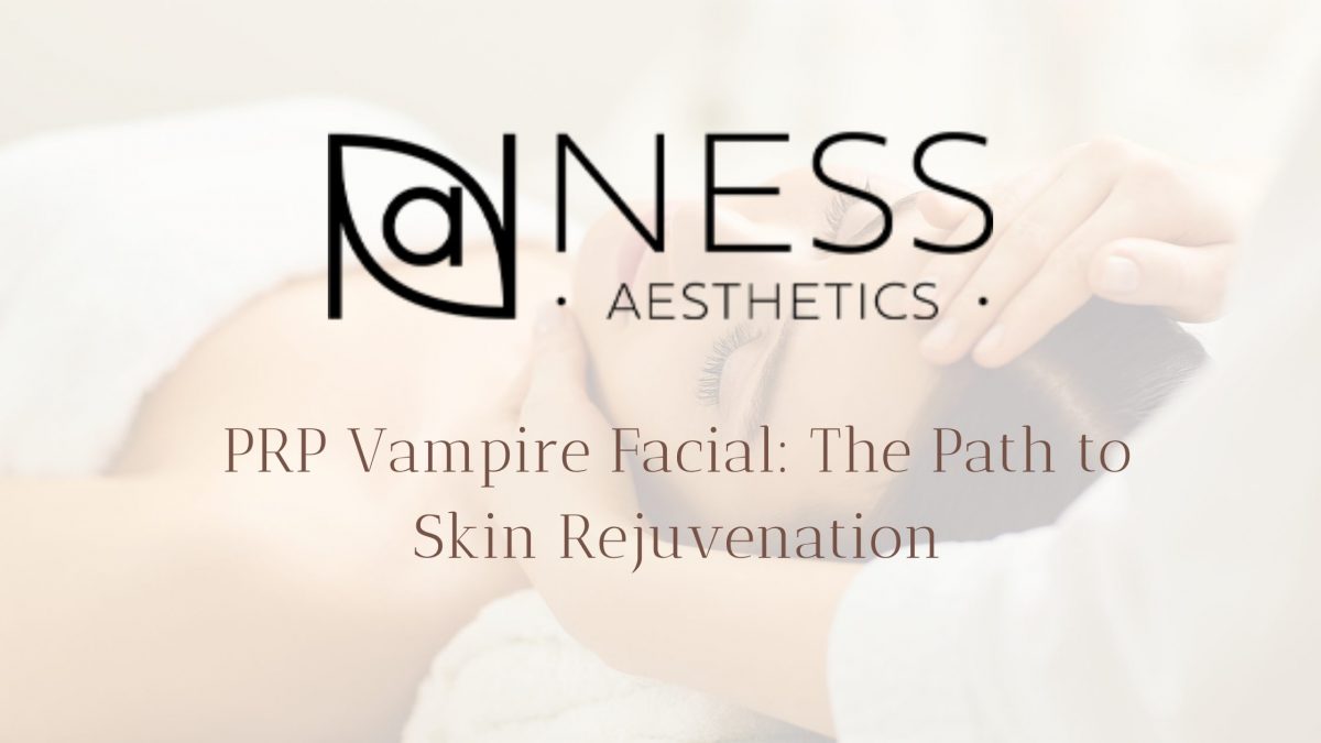 PRP Vampire Facial: The Path to Skin Rejuvenation - Ness Aesthetics