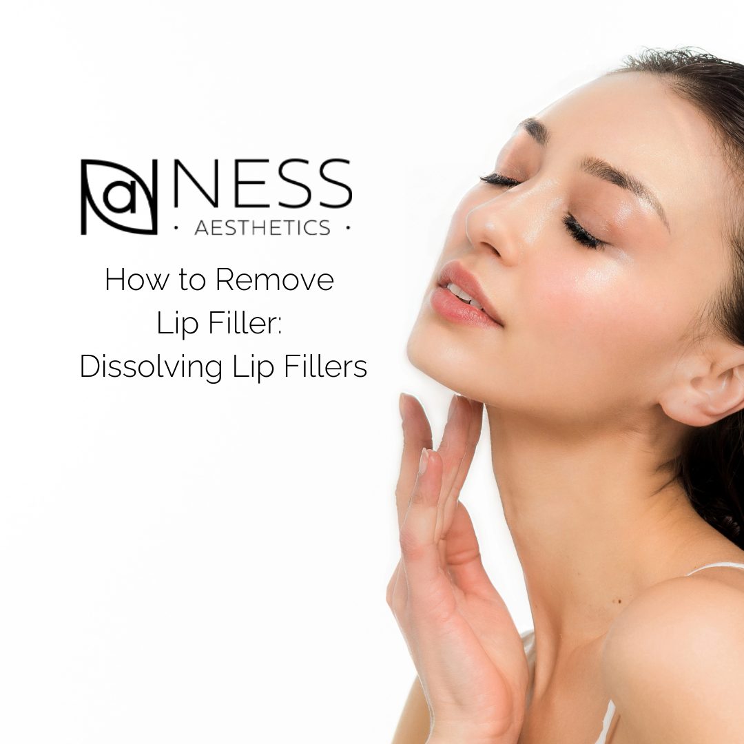 How to Remove Lip Filler: Dissolving Lip Fillers - Ness Aesthetics