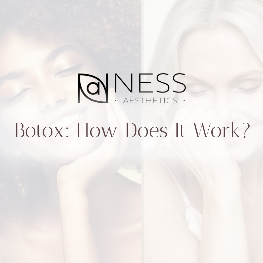 Botox: How Does It Work? - Ness Aesthetics