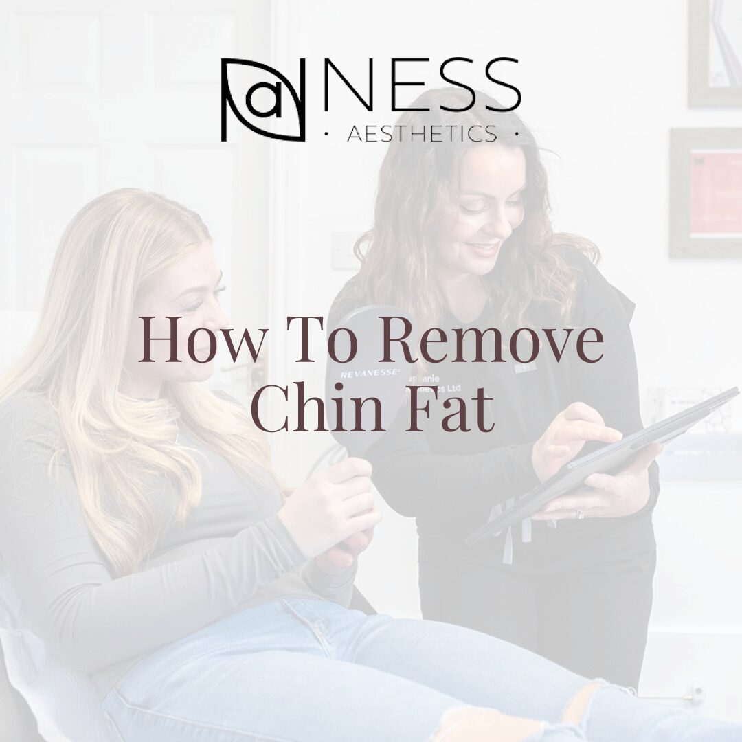How to Remove Chin Fat? - Ness Aesthetics